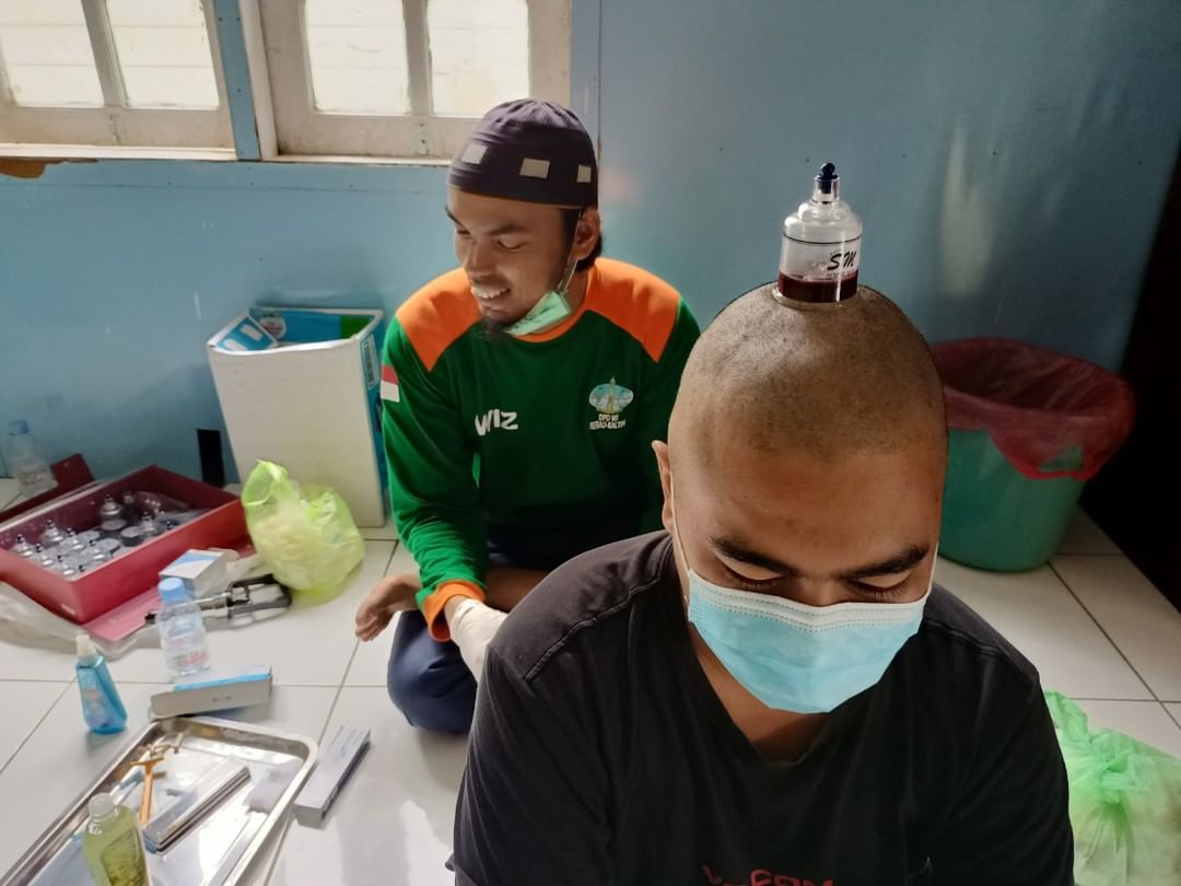 Kolaborasi Wiz Dan Wp Bantu Warga Untuk Sehat Melalui Terapi Bekam ...